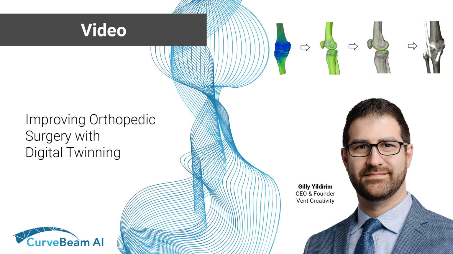Improving Orthopedic Surgery with Digital Twinning - CurveBeam AI